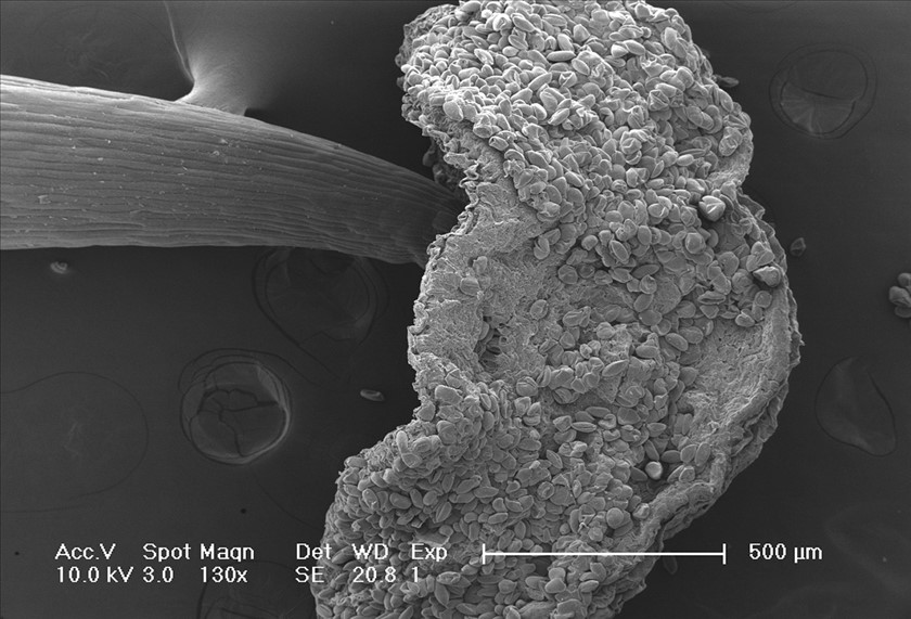 צמח השדה | קרן קימת לישראל - חצב מצוי